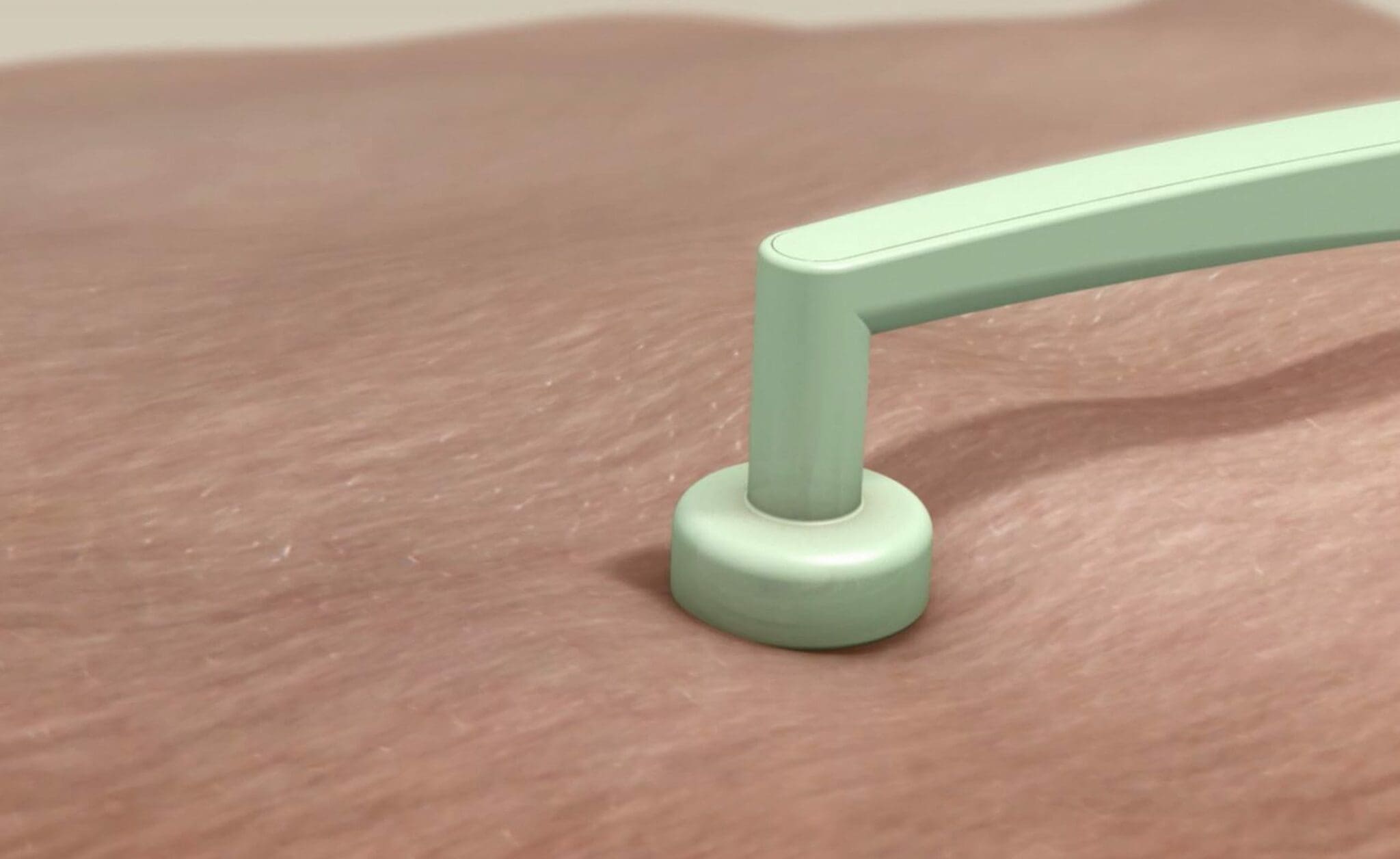 The Science Behind BodyTite Body Contouring Technology